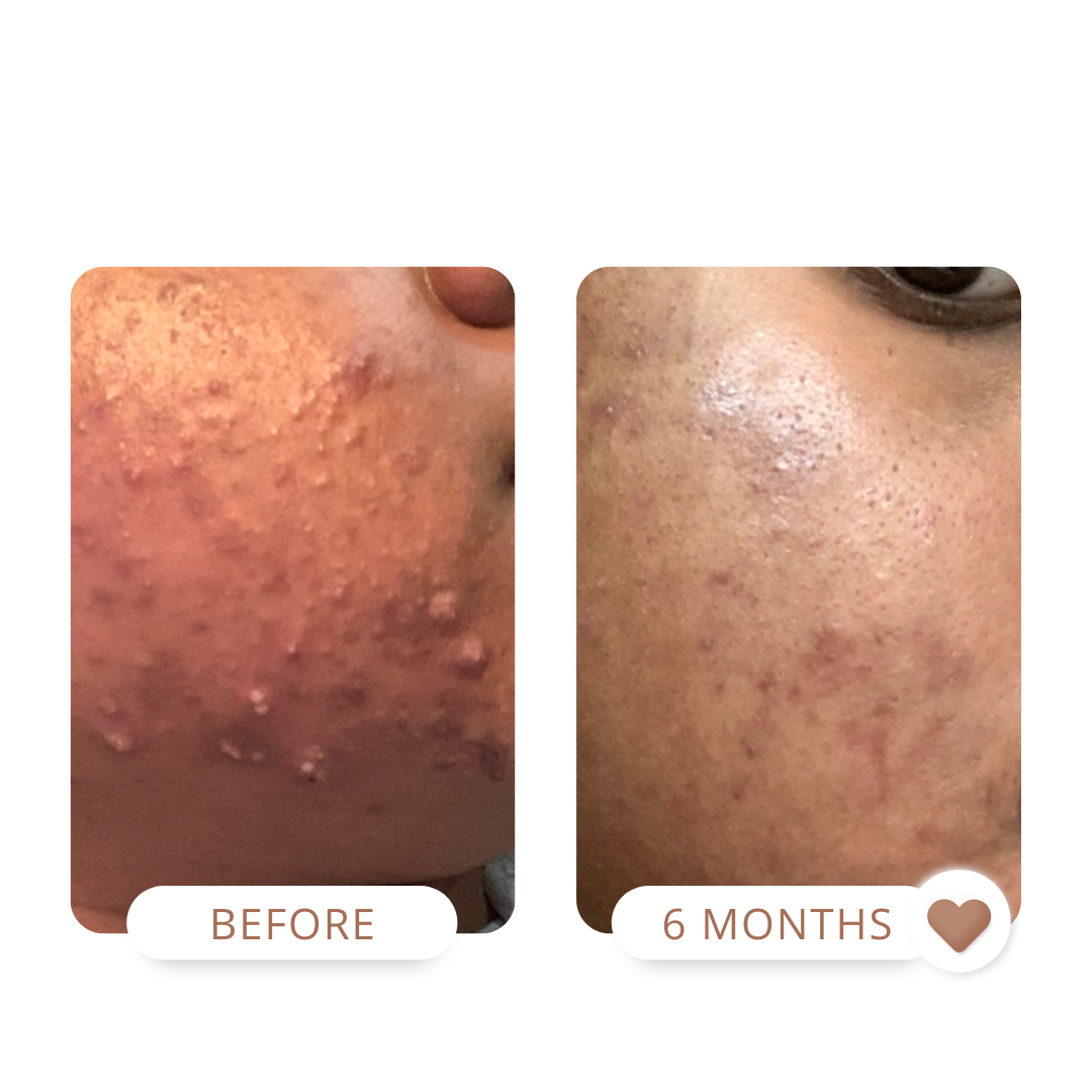 The Trifecta | Combination Skin Kit – Ammu Beauty