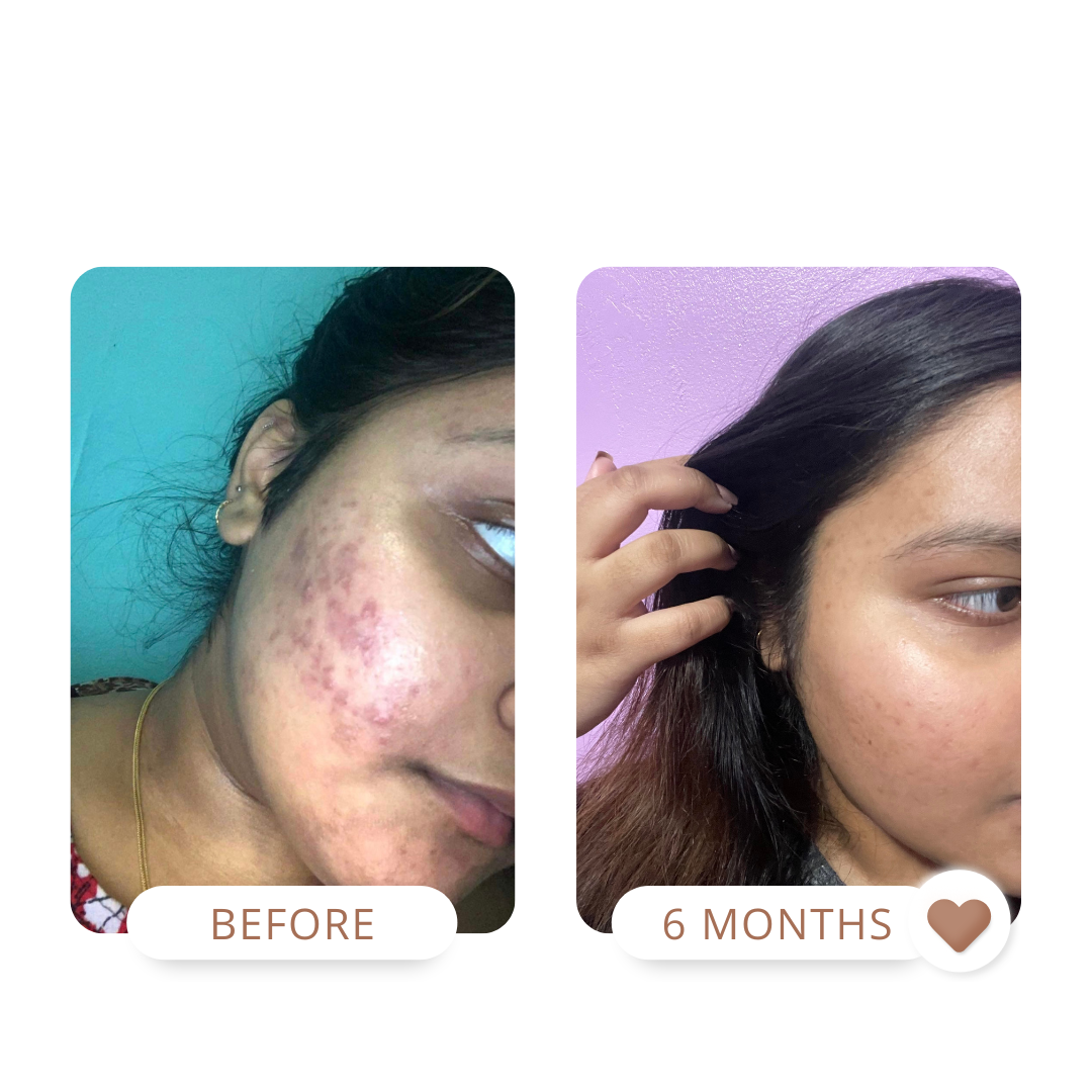 The Trifecta | Combination Skin Kit – Ammu Beauty